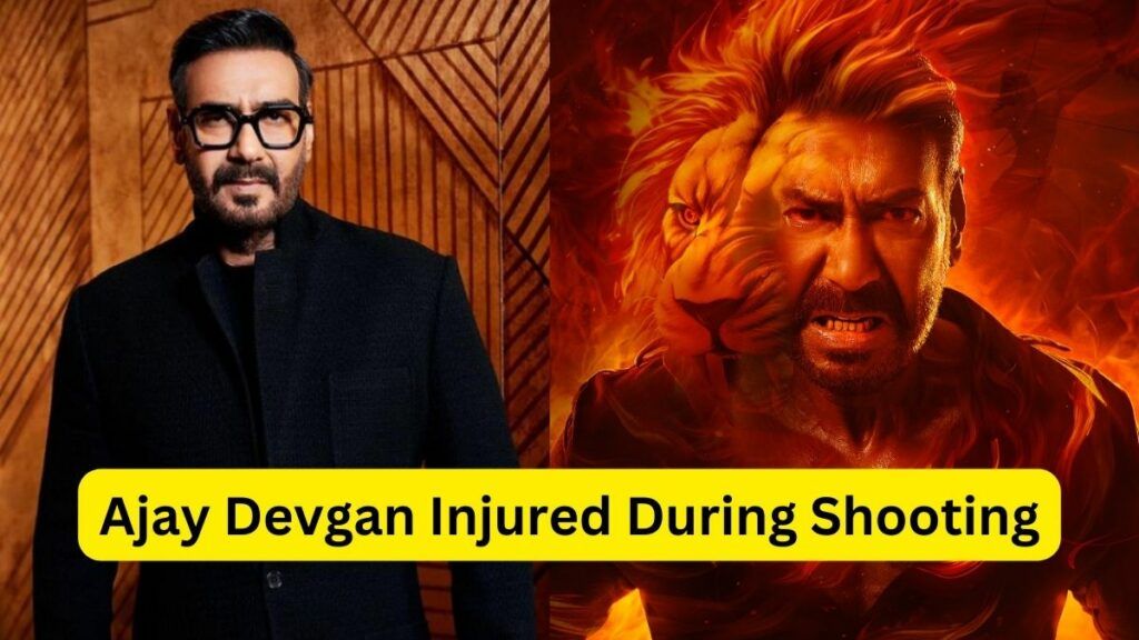Ajay Devgan Injured During Shooting: Ajay Devgan got injured during ...